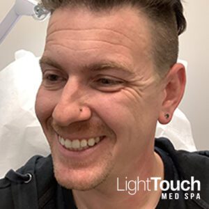 Botox® Summer Specials | LightTouch Med Spa